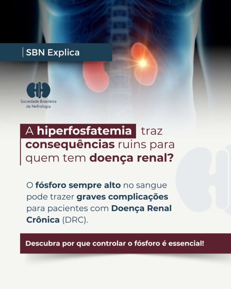 SBN Explica: Como o fósforo alto afeta o paciente? – SBN